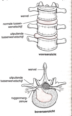 Acupunctuur Vledder (Drenthe) - Chi-Ori.nl